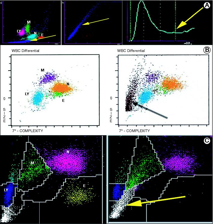 Découvrir 136+ imagen formule leucocytaire cancer - fr.thptnganamst.edu.vn Découvrir 136+ imagen formule leucocytaire cancer - fr.thptnganamst.edu.vn